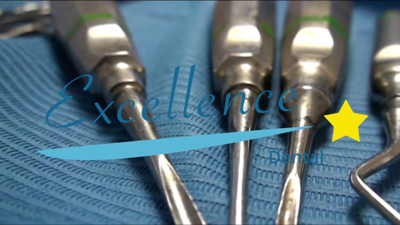 Full lower Jaw Reconstruction and Removal of mandibular tori By Dr. Amy ...