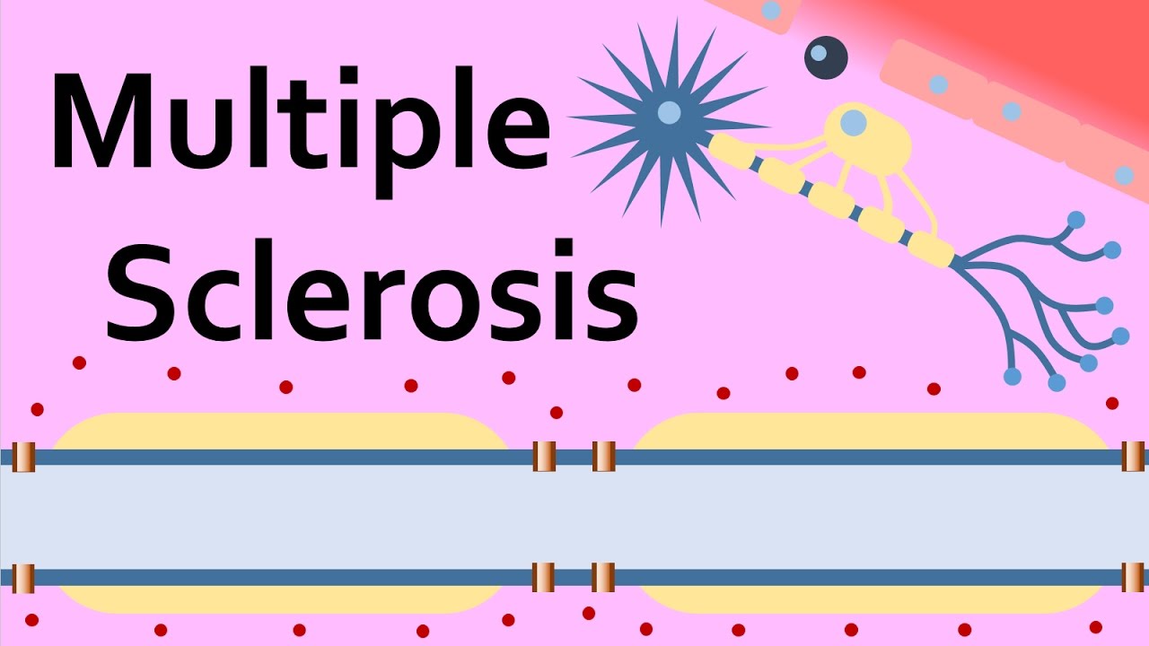 Multiple Sclerosis and the Myelin Sheath - YouTube