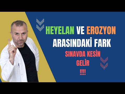 HEYELAN VE EROZYON ARASINDAKİ FARK #tytcoğrafya #coğrafya #tyt #ayt #yks #kpss