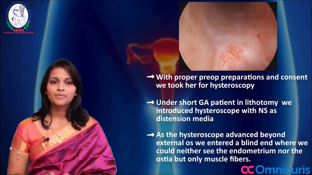 False Passage | Hysteroscopy - YouTube