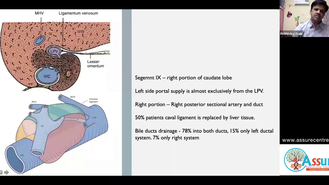 SURGICAL GASTRO/ HPB by Dr Prithiviraj @ ASSURE - Liver anatomy (Model ...