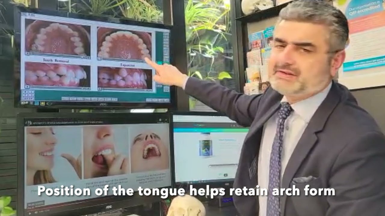 Specialist Orthodontist Dr Derek Mahony teaches tongue elevation and ...