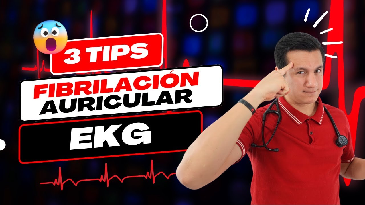 Diagnosticando Fibrilación auricular con respuesta ventricular rápida ...