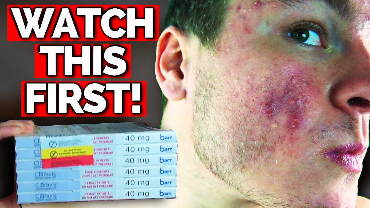 The ULTIMATE Accutane Video (You NEED To Know This) - YouTube
