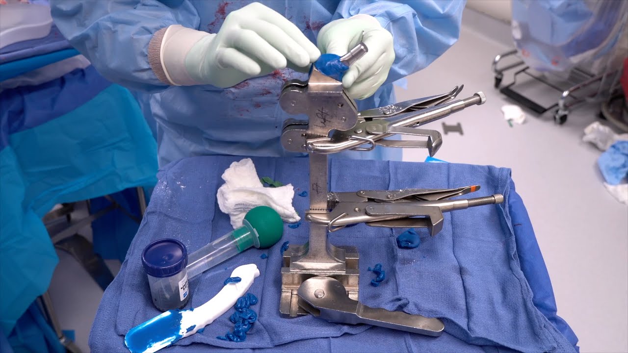Articulating Hip Spacer Preparation - Prostalac Hip System - YouTube