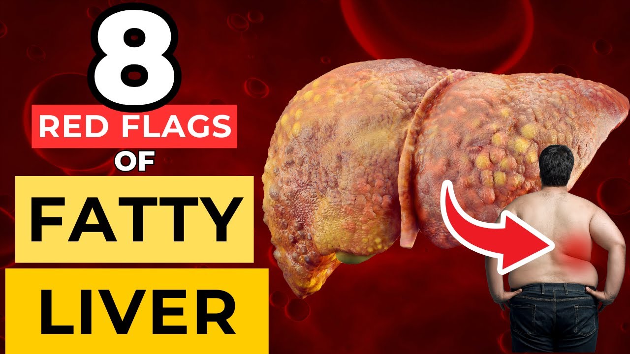 8 Red Flags of a Fatty LIVER You Must Know - YouTube