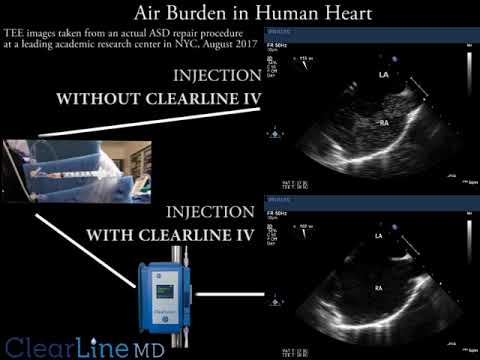 ClearLine IV - Proven to Reduce Dangerous Air Burden - YouTube