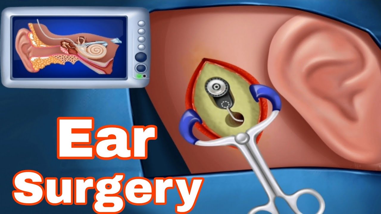 ASMR ear surgery animation video / 3d medical animation - YouTube