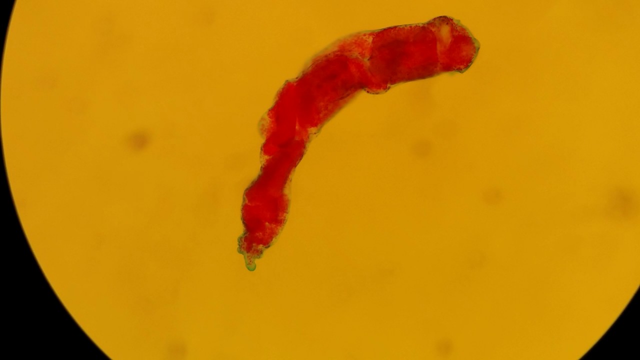 Fasciola hepatica redia - YouTube