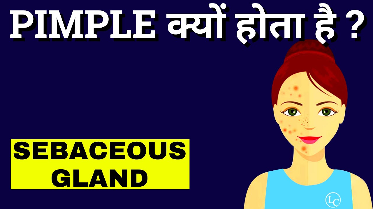How Pimples Are Formed | How Pimple Occurs On Face | How Pimples Are ...