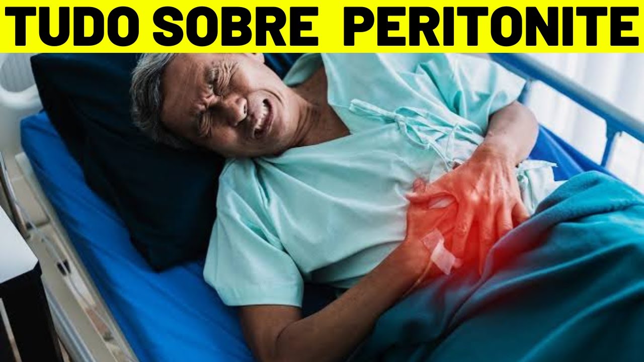 O QUE É PERITONITE? SINTOMAS, CAUSAS E TRATAMENTO - YouTube