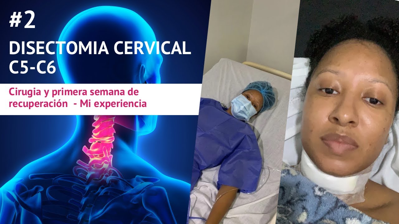 2- RECUPERACIÓN DE CIRUGÍA CERVICAL | PRIMERA SEMANA LUEGO DE QUITAR ...