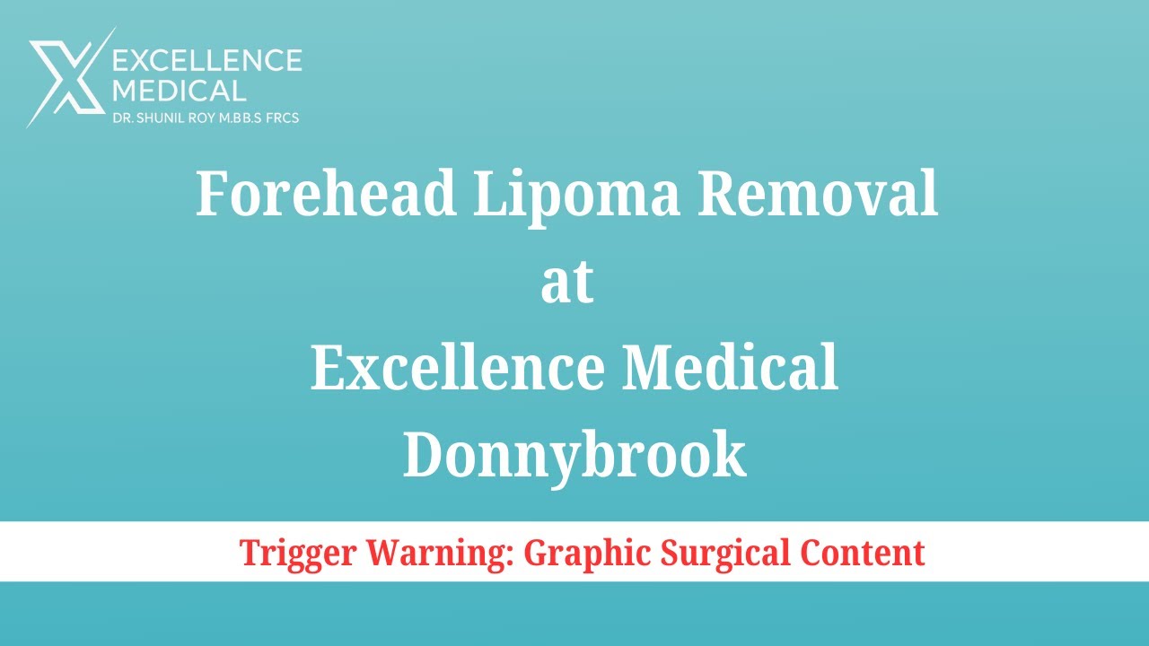 Surgical Removal of Deep Forehead Lipoma at Excellence Medical ...
