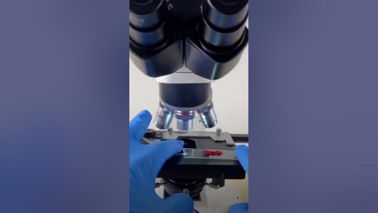 Testing Strawberry Under Microscope Microscope Youtube