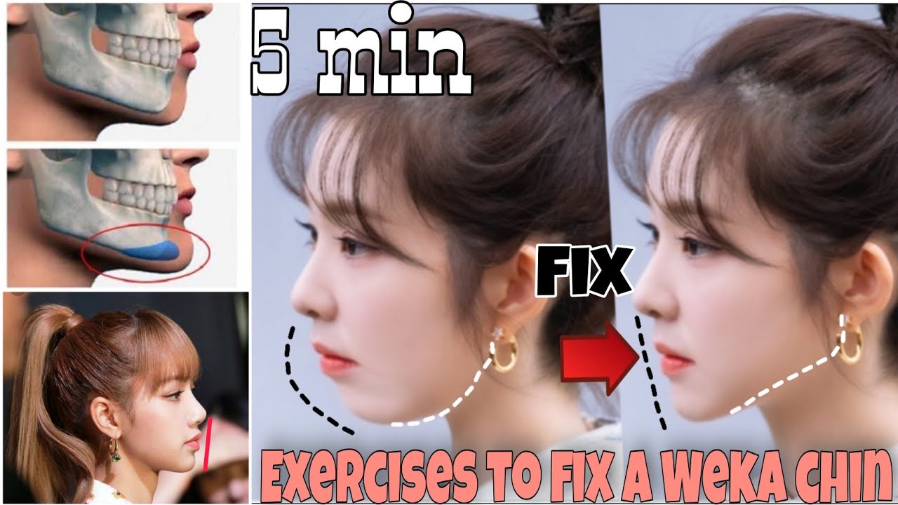 Top Exercises to Fix a Sagging Chin - Reduce Chin fat & Elongate Your ...