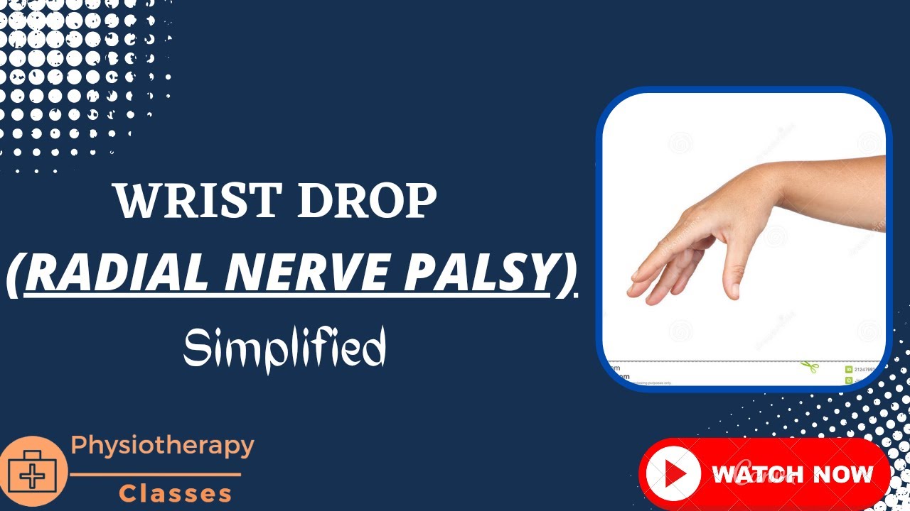 Wrist drop | wrist drop anatomy | wrist drop nerve - YouTube