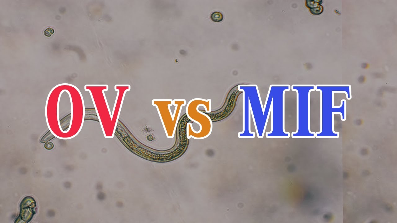 ความแตกต่างระหว่าง (Opisthorchis Viverrini : OV) vs (Minute Intestinal ...