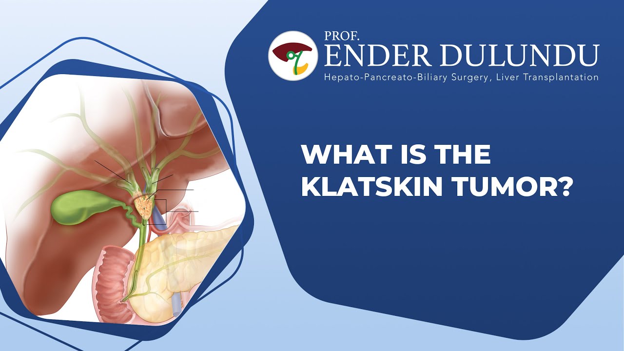 What is the Klatskin Tumor I Prof Ender Dulundu - YouTube