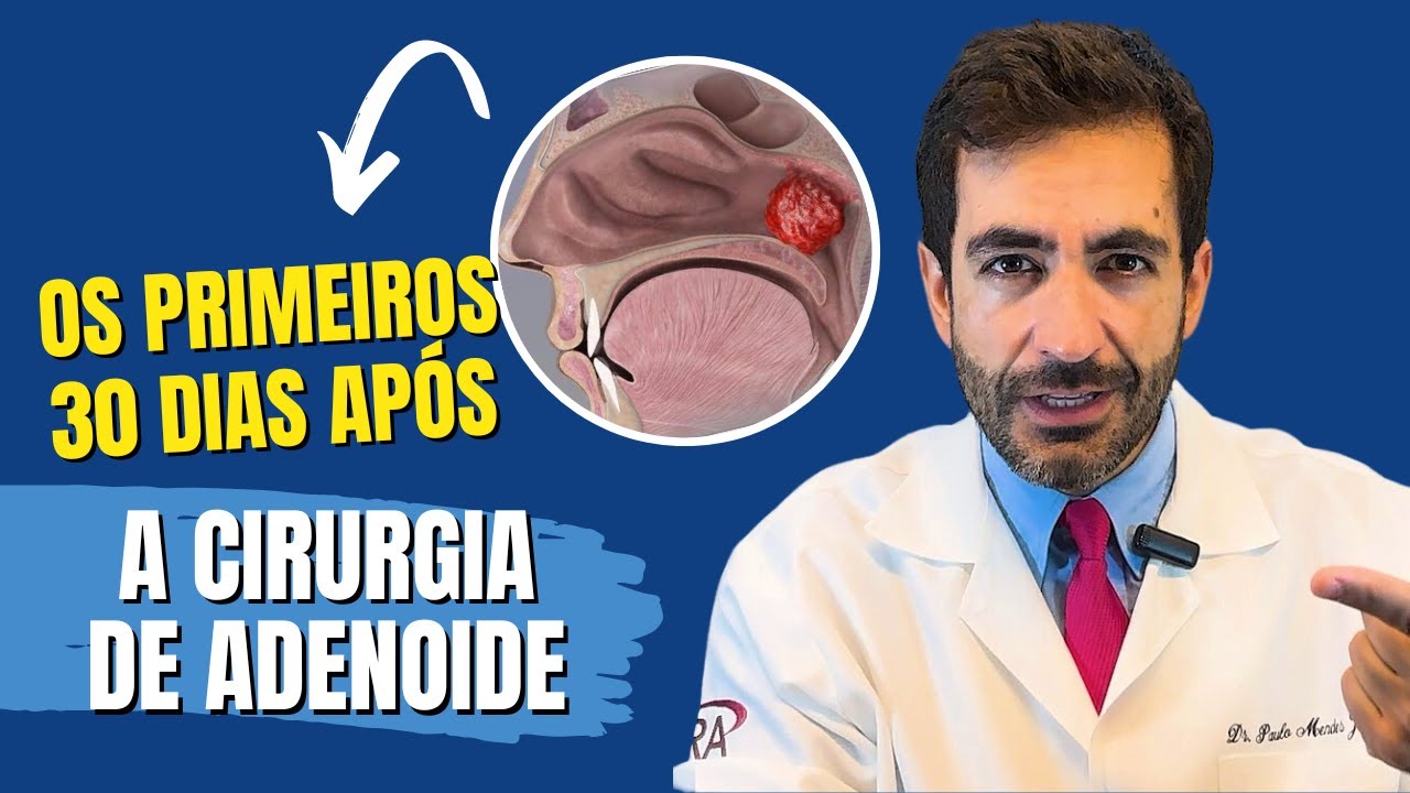 O que esperar após cirurgia de adenoide nos primeiros 30 dias - YouTube