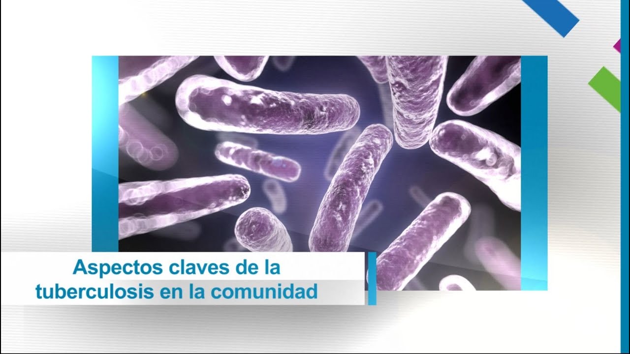 Aspectos claves de la tuberculosis en la comunidad - YouTube