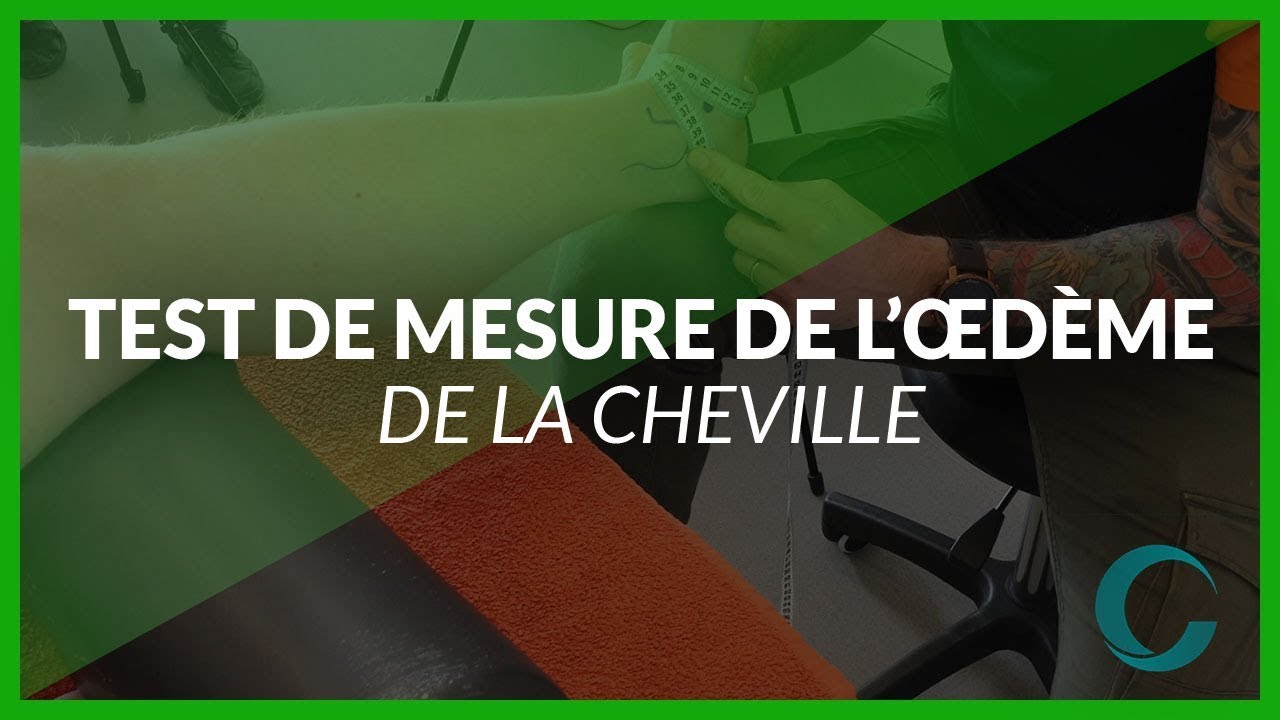 Test de la Mesure de l’œdème de la Cheville - YouTube