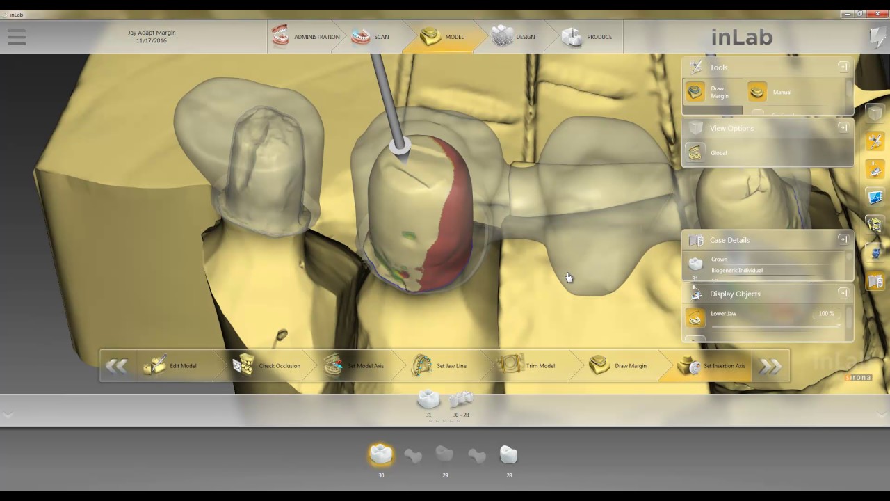 inLab SW 16 CAD and CAM Webinar - YouTube