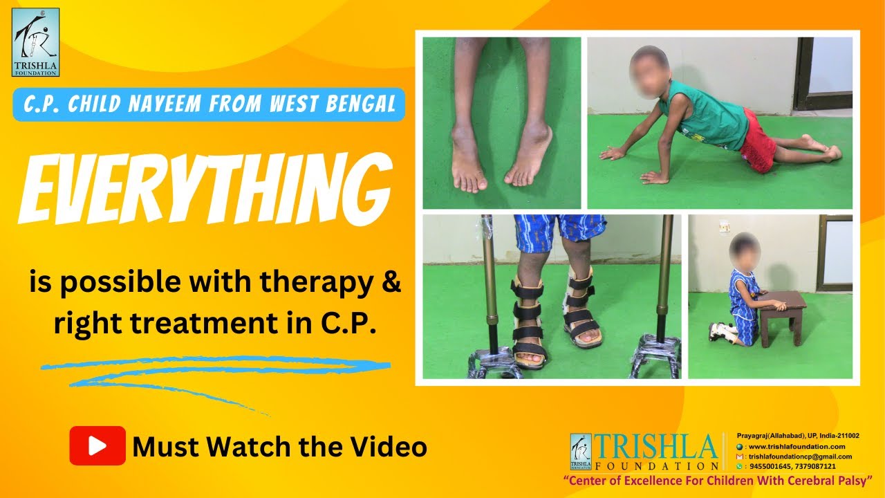 Cerebral Palsy Child Takes First Step! A Journey from Plaster to ...