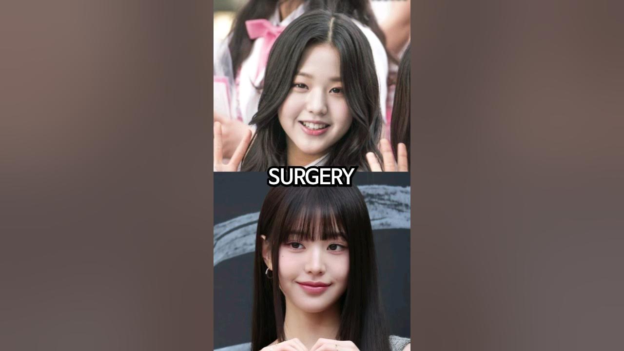 JANG WONYOUNG (IVE) Have Plastic Surgery? #plasticsurgery #kpop #shorts - YouTube