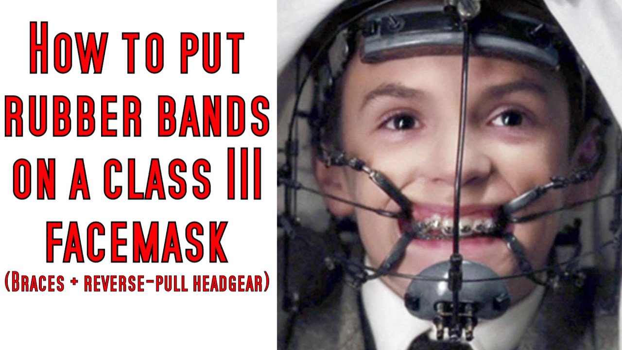 How to put rubber bands on braces protraction facemask - YouTube