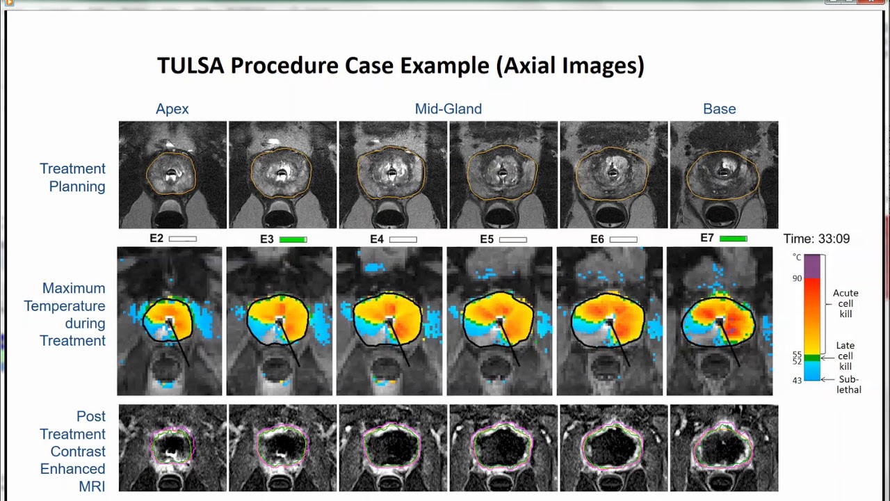 TULSA-PRO Axia Imaging - YouTube