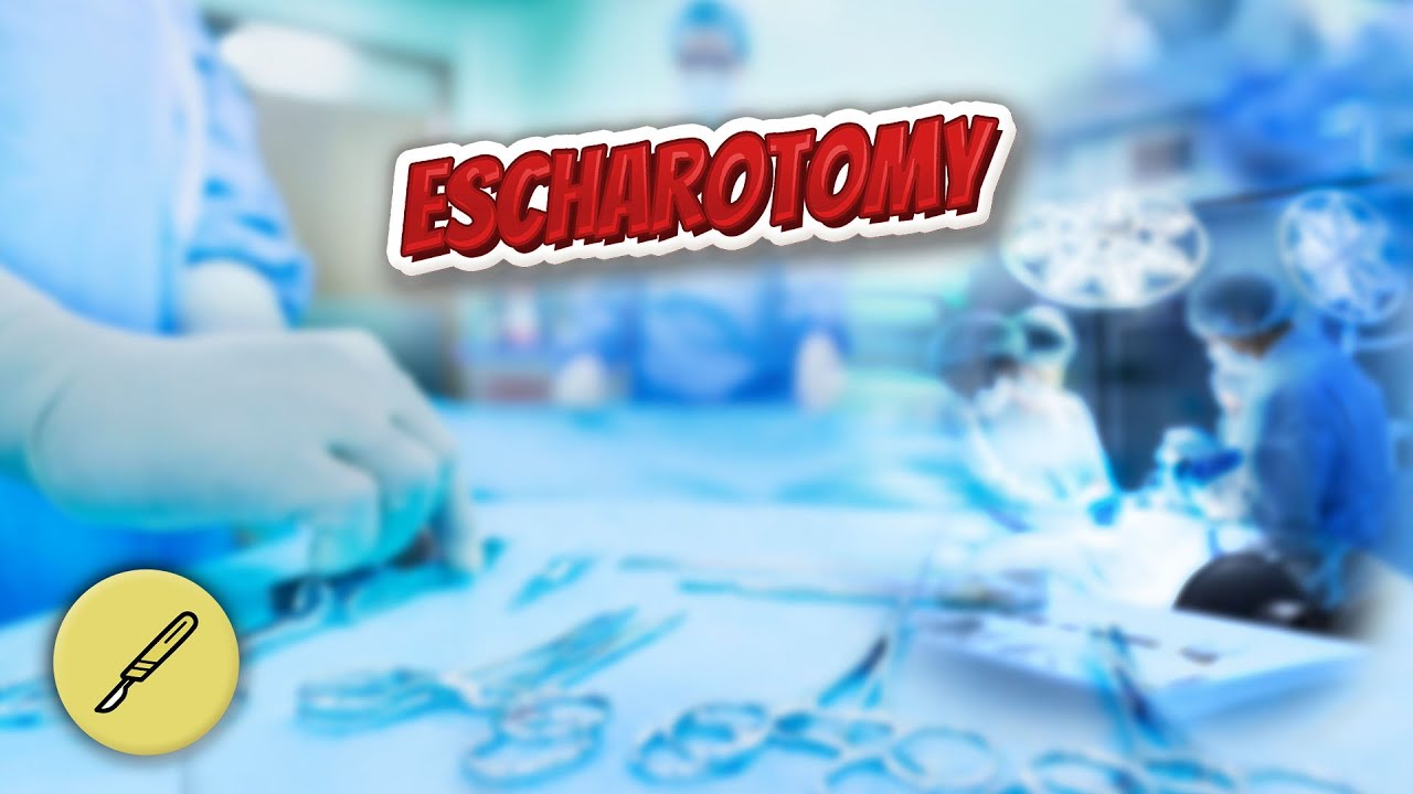 Escharotomy - Everything Surgeries 😬⁉️ - YouTube