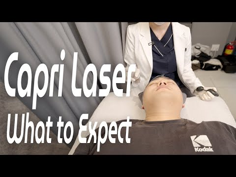 Transform Your Skin with Capri Laser | Skin&Beam Skin Clinic's Special ...
