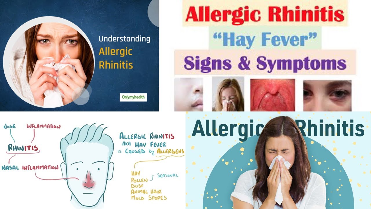 How to treat allergic rhinitis - YouTube