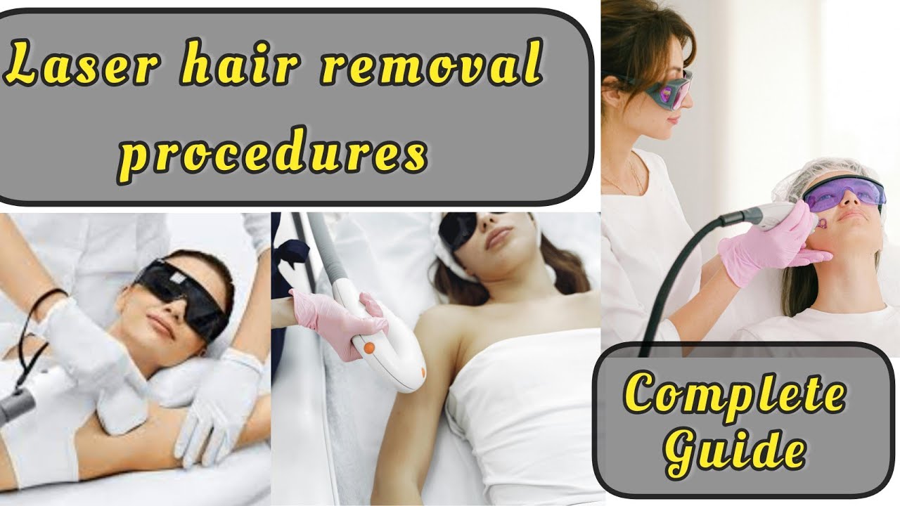 how laser hair removal procedures works comprehensive guide - YouTube