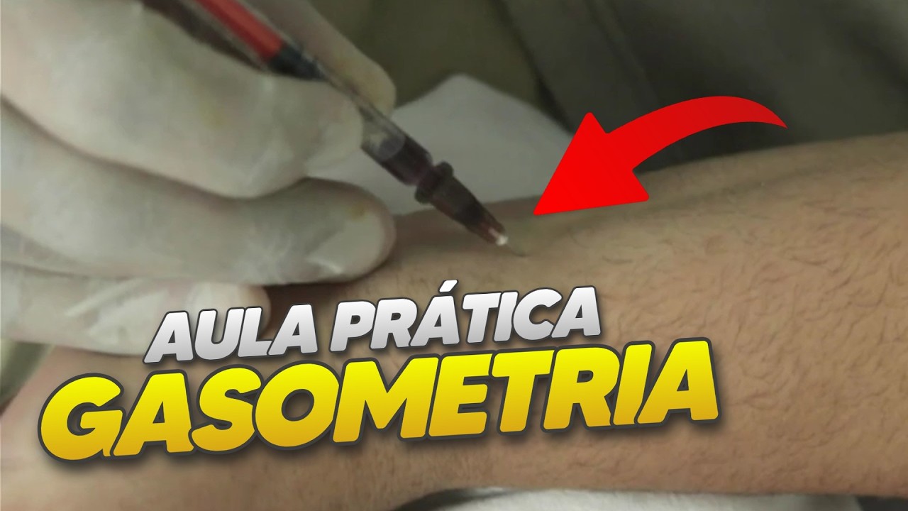 COLETA PRÁTICA DE GASOMETRIA ARTERIAL - COMO COLETAR GASOMETRIA - YouTube