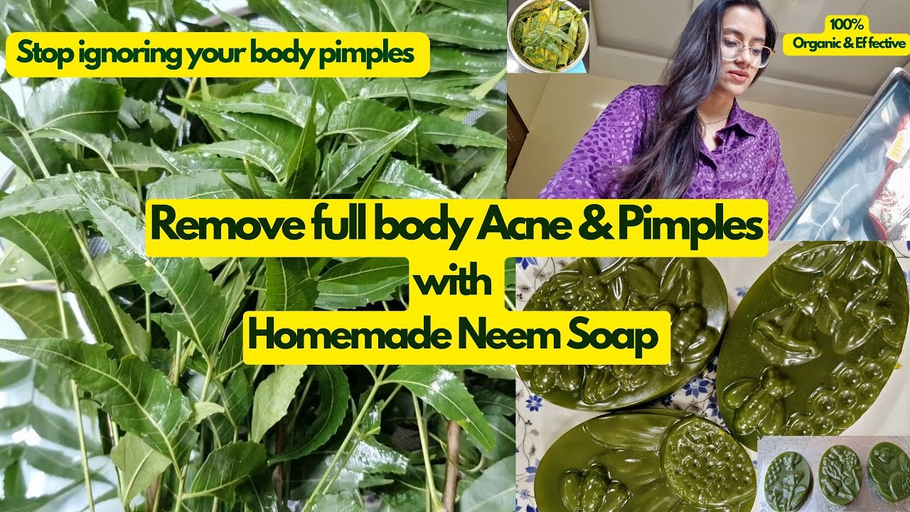 Get Pimple-Free, Clean & Bright Skin at Home | Homemade Neem Soap ...