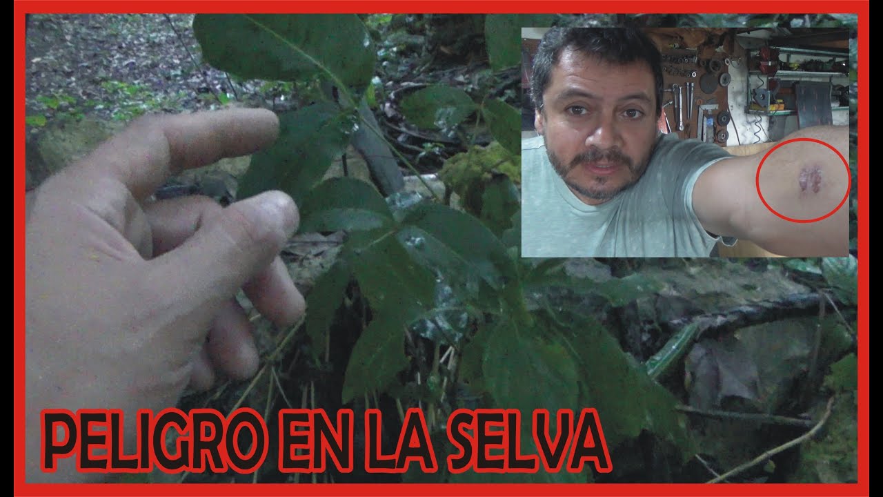 La sabia de este árbol te puede quemar la piel - YouTube
