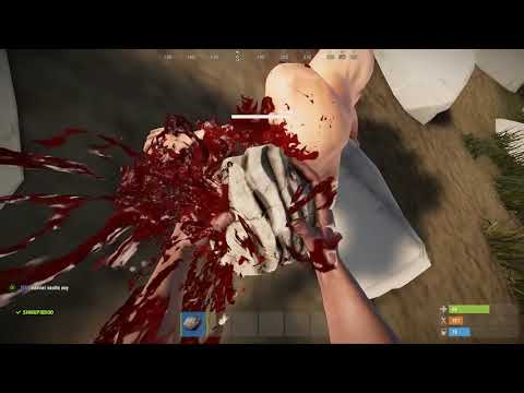 My epic moments in SOLO | DUO | TRIO in Naked people