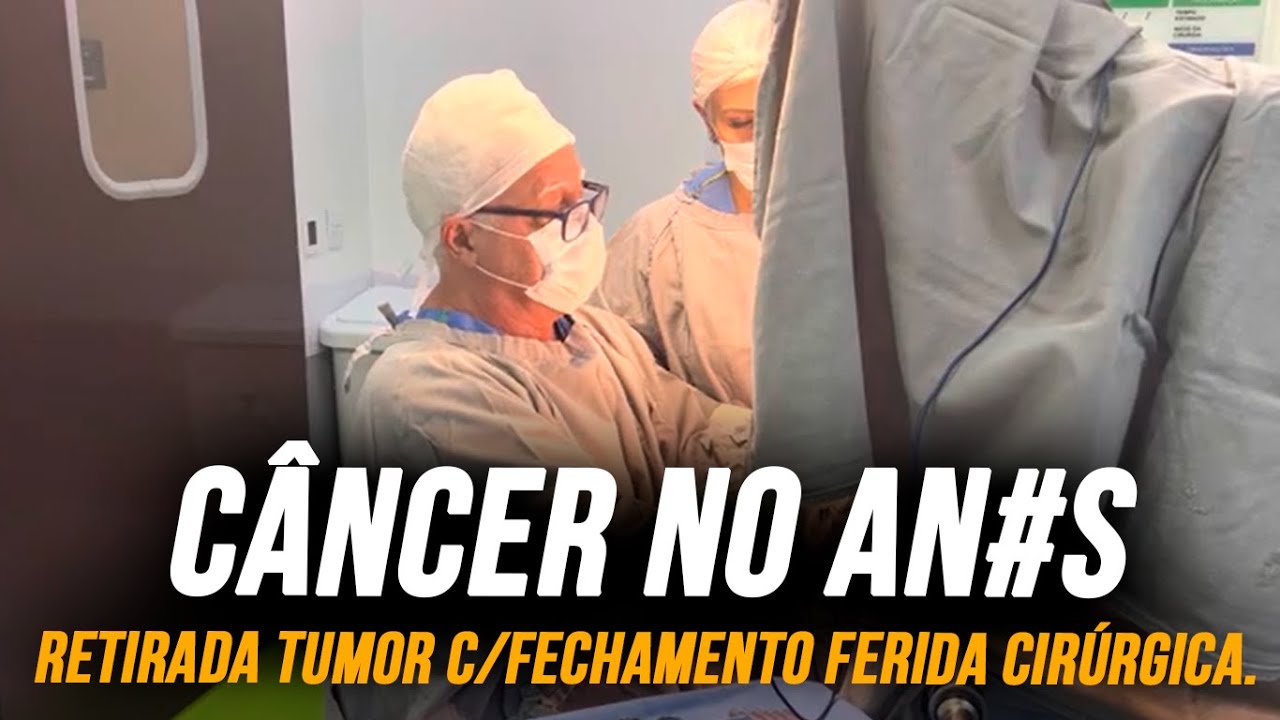 Câncer anus: Retirada tumor c/fechamento ferida cirúrgica. - YouTube