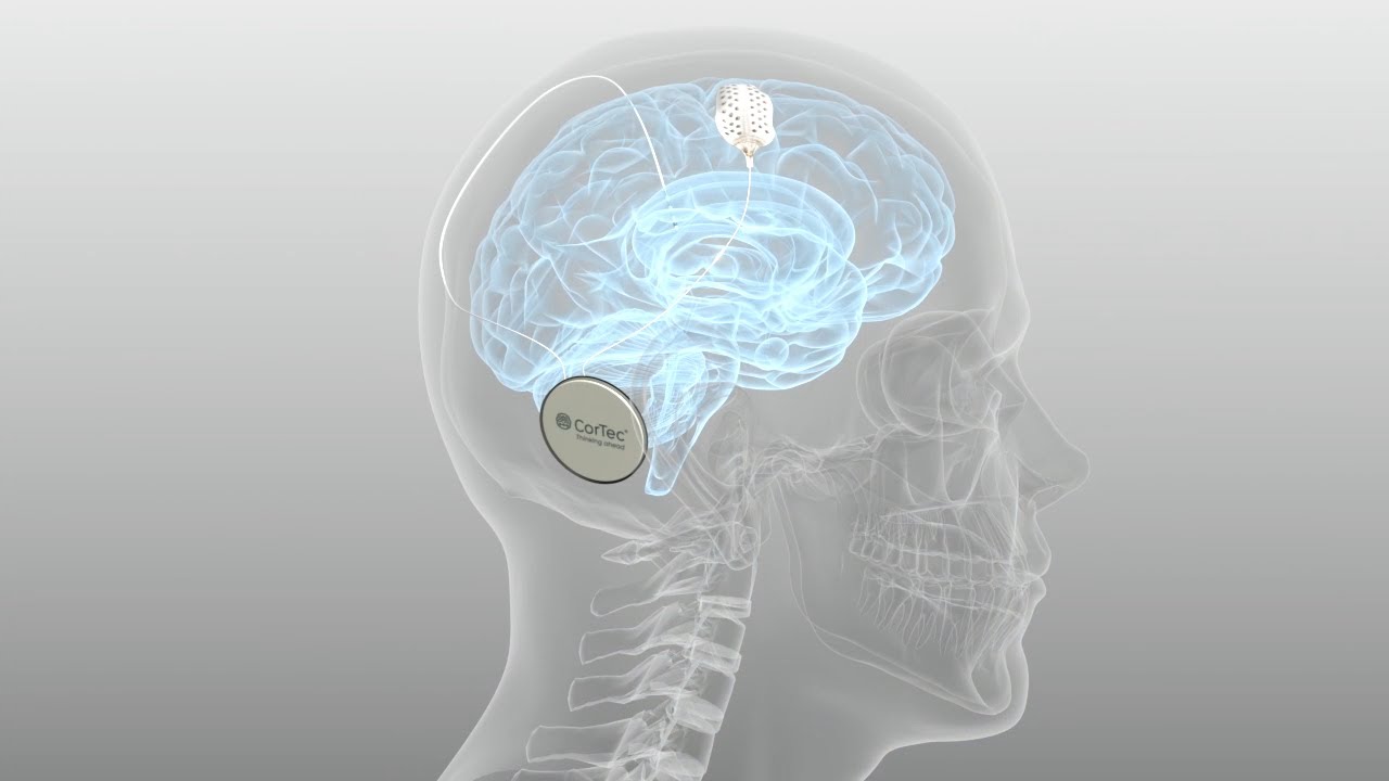 CorTec Brain Interchange System - Closed Loop Brain Computer Interface ...