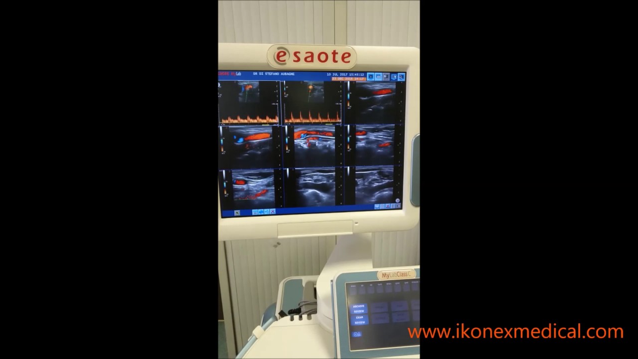 Esaote MyLab Class C Ultrasound Unit - YouTube