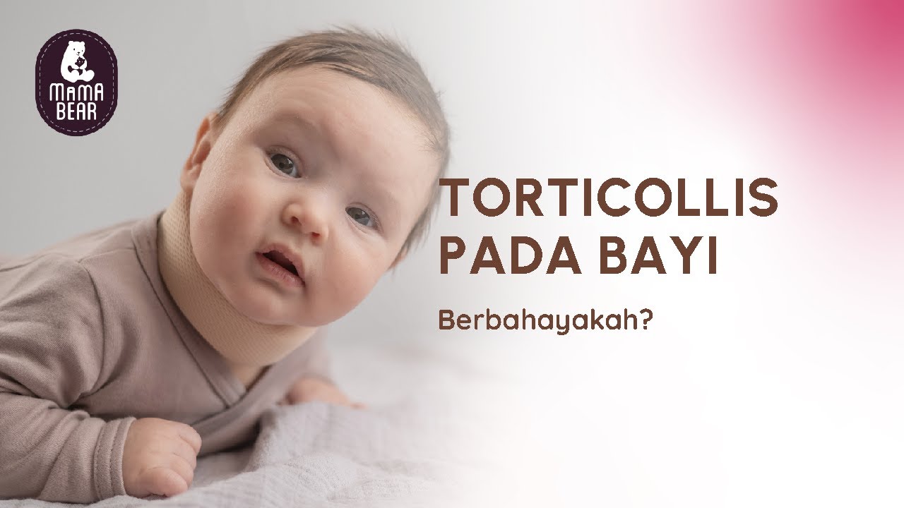Torticollis Pada Bayi, Berbahayakah? - YouTube