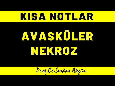 AVASKÜLER NEKROZ, KISA NOTLAR,,Serdar Akgün, Tıp Dersleri, Serdar Akgün Tıp Videoları