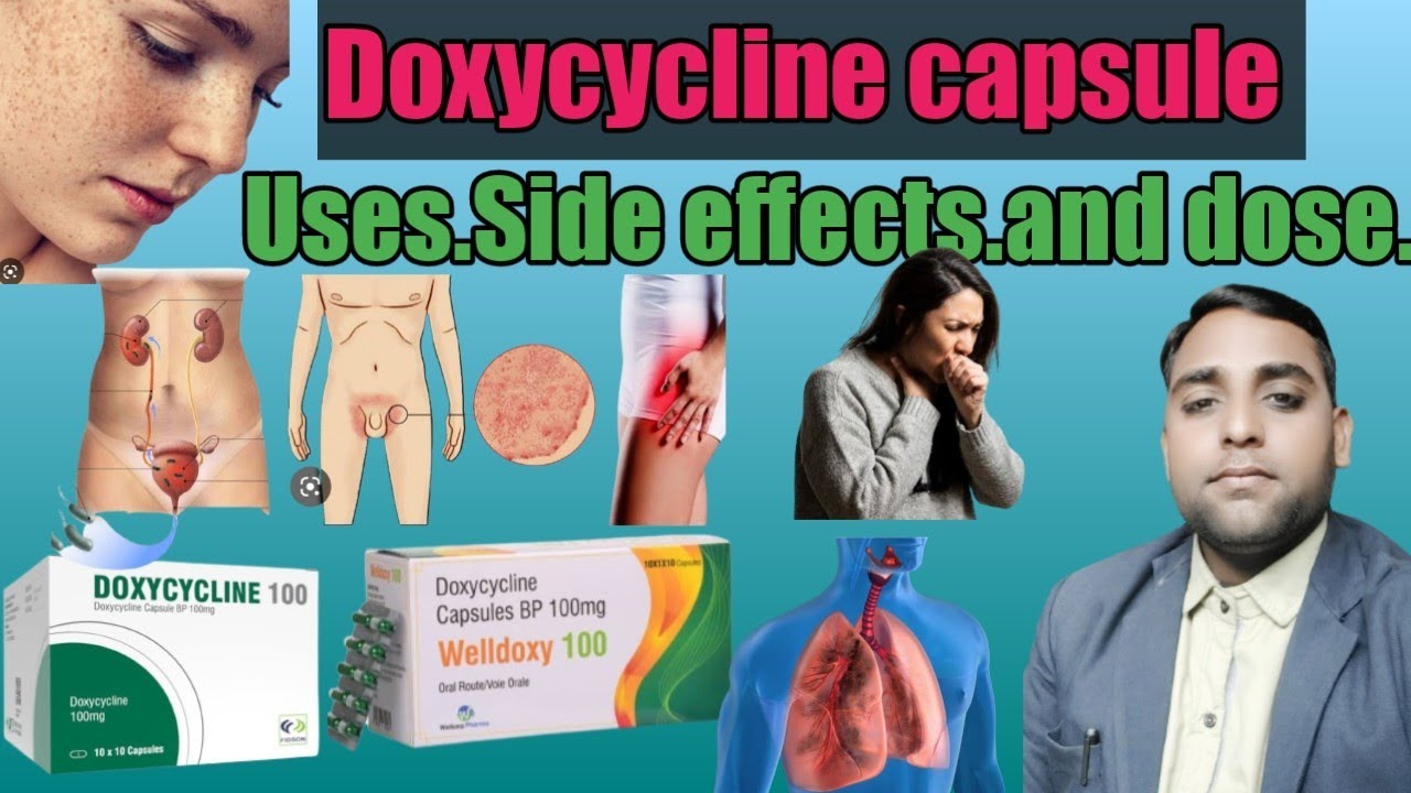 Doxycycline Capsule IP 100mg.antibiotics medicine . doxycycline capsule ...