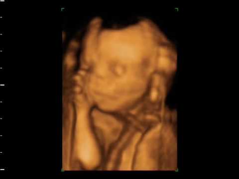 20 Week 4D Ultrasound Baby Scan