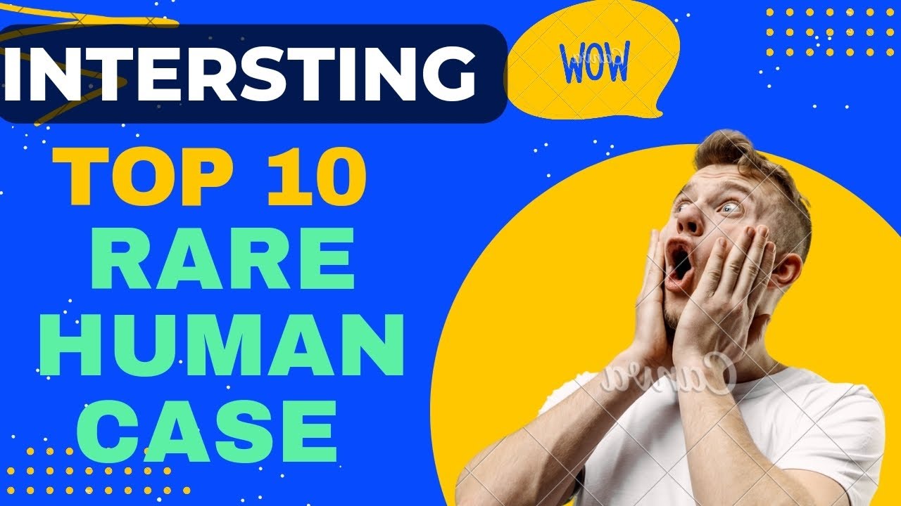 Top 10 Interesting Rare human cases - The facts zone with bashu 🌟 - YouTube