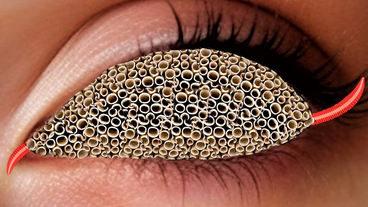 ASMR how to remove bryozoan trypophobia infected of eyes | ASMR severely affected eyes | ASMR ...