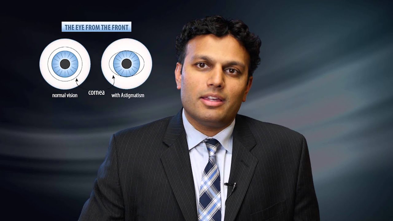 Milan Eye Centers Precision Vision With RXsight's Light Adjustable