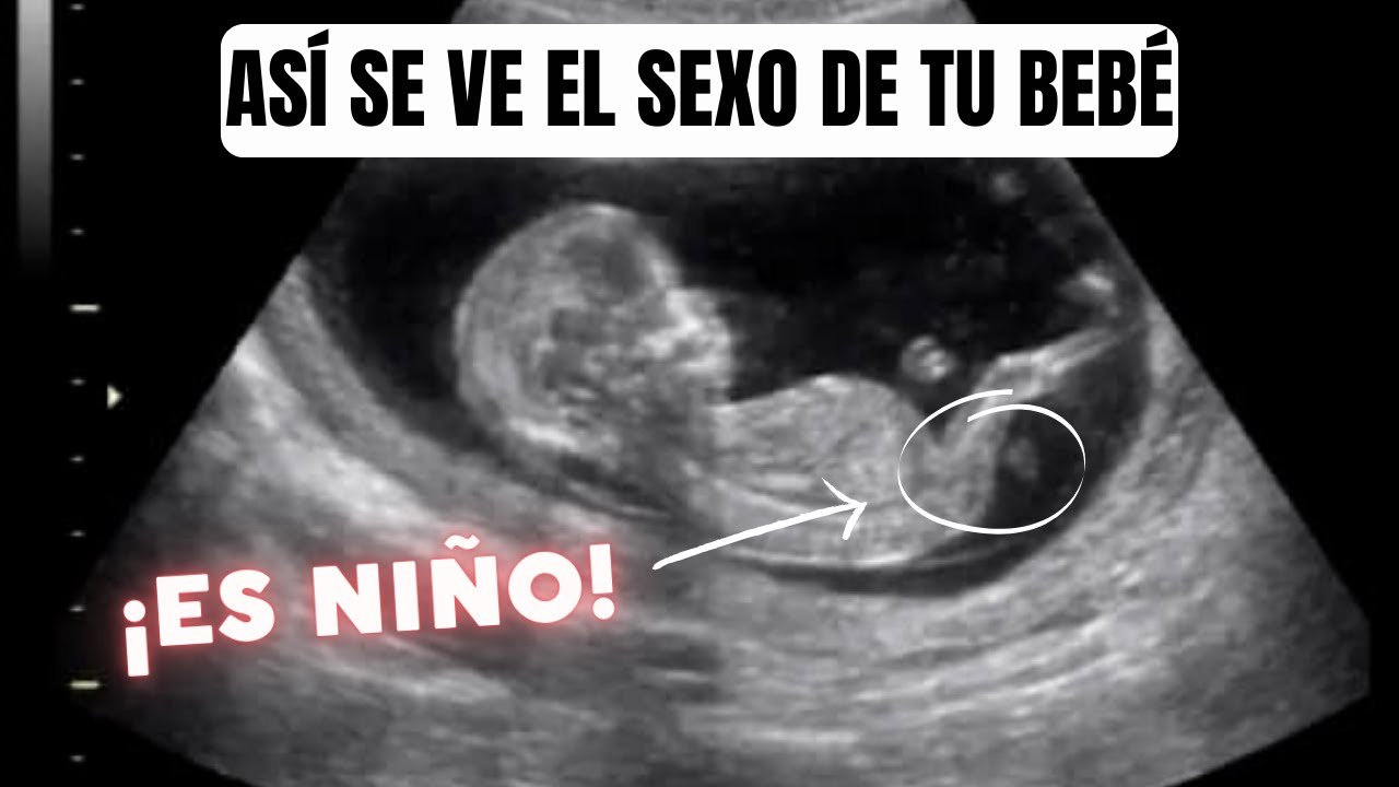 Como saber el sexo de tu Bebé ¿Es Niño o Niña? ¿Sirve el Método RAMZI ...