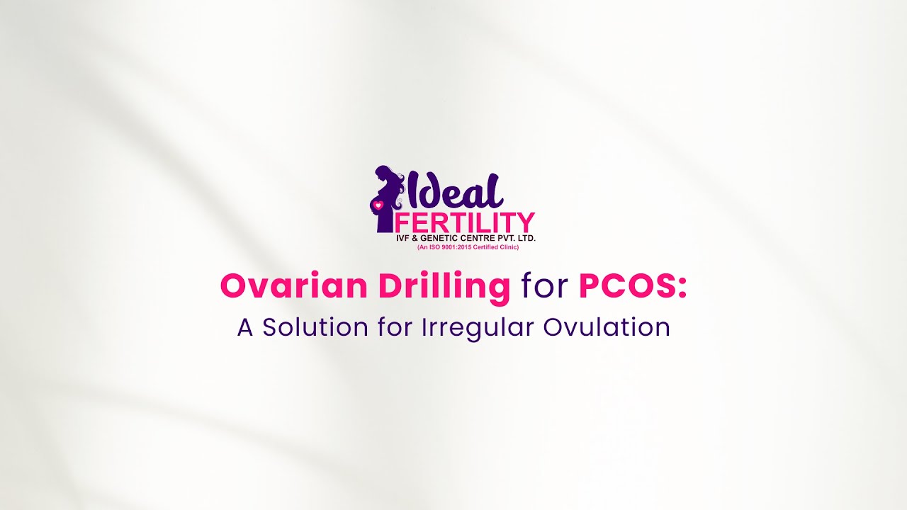 Ovarian Drilling for PCOS A Solution for Irregular Ovulation - YouTube
